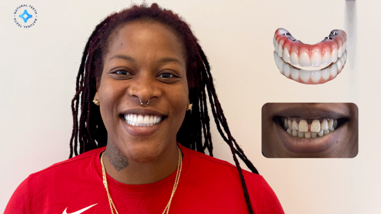 Full Mouth Dental Implants Is This the Right Solution for You in ...